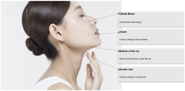 V-LINE SOL | Korean Fillers