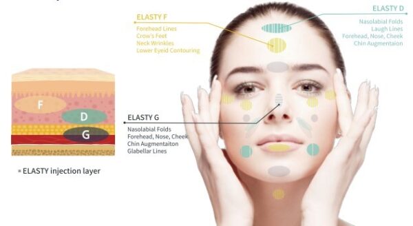 ELASTY G PLUS | Korean Fillers